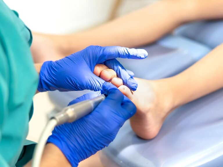 Routine Podiatry Treatment | St Marychurch Foot Clinic